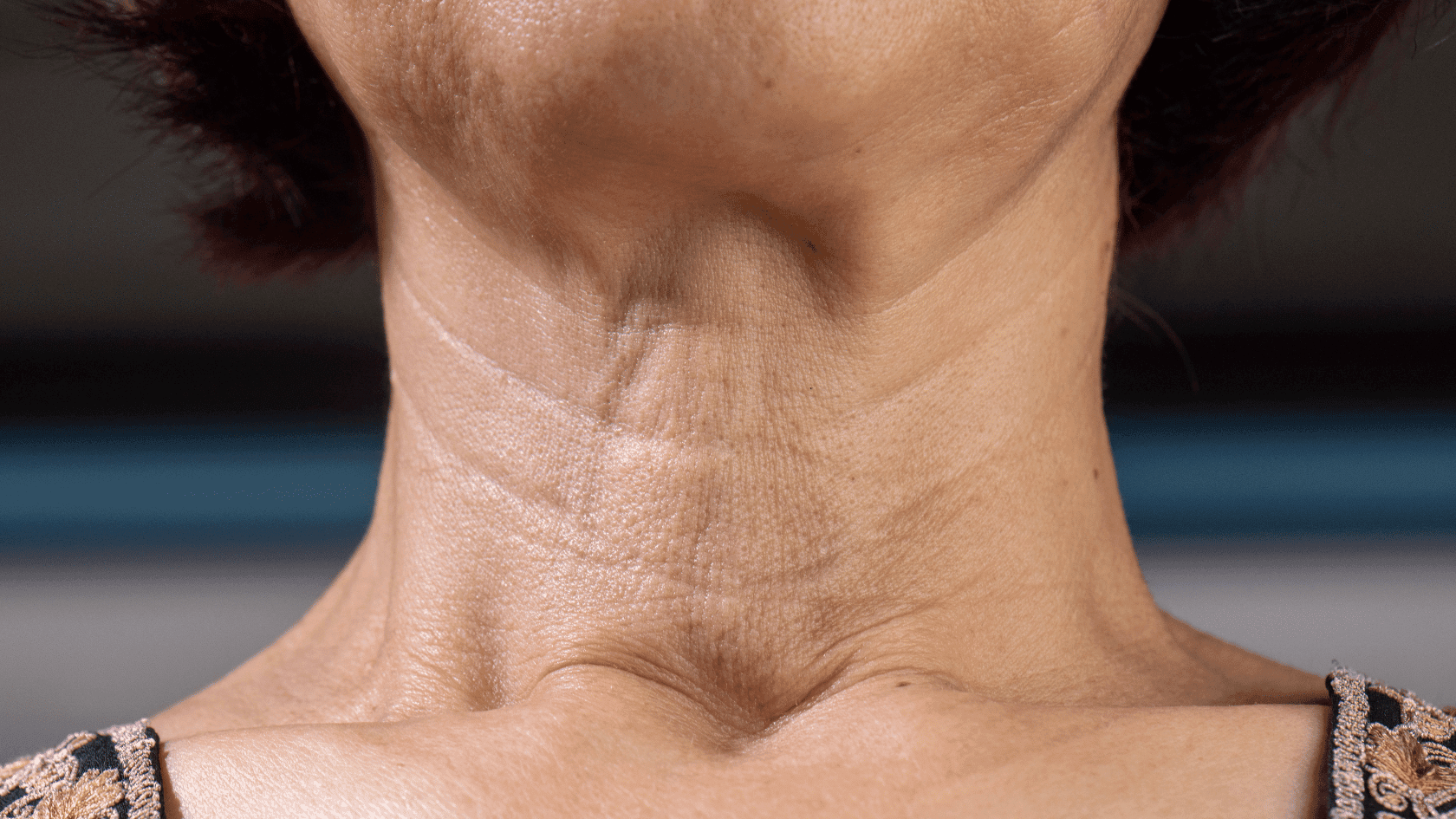 Sagging Skin - Causes & Treatments | Birmingham Skin Clinic